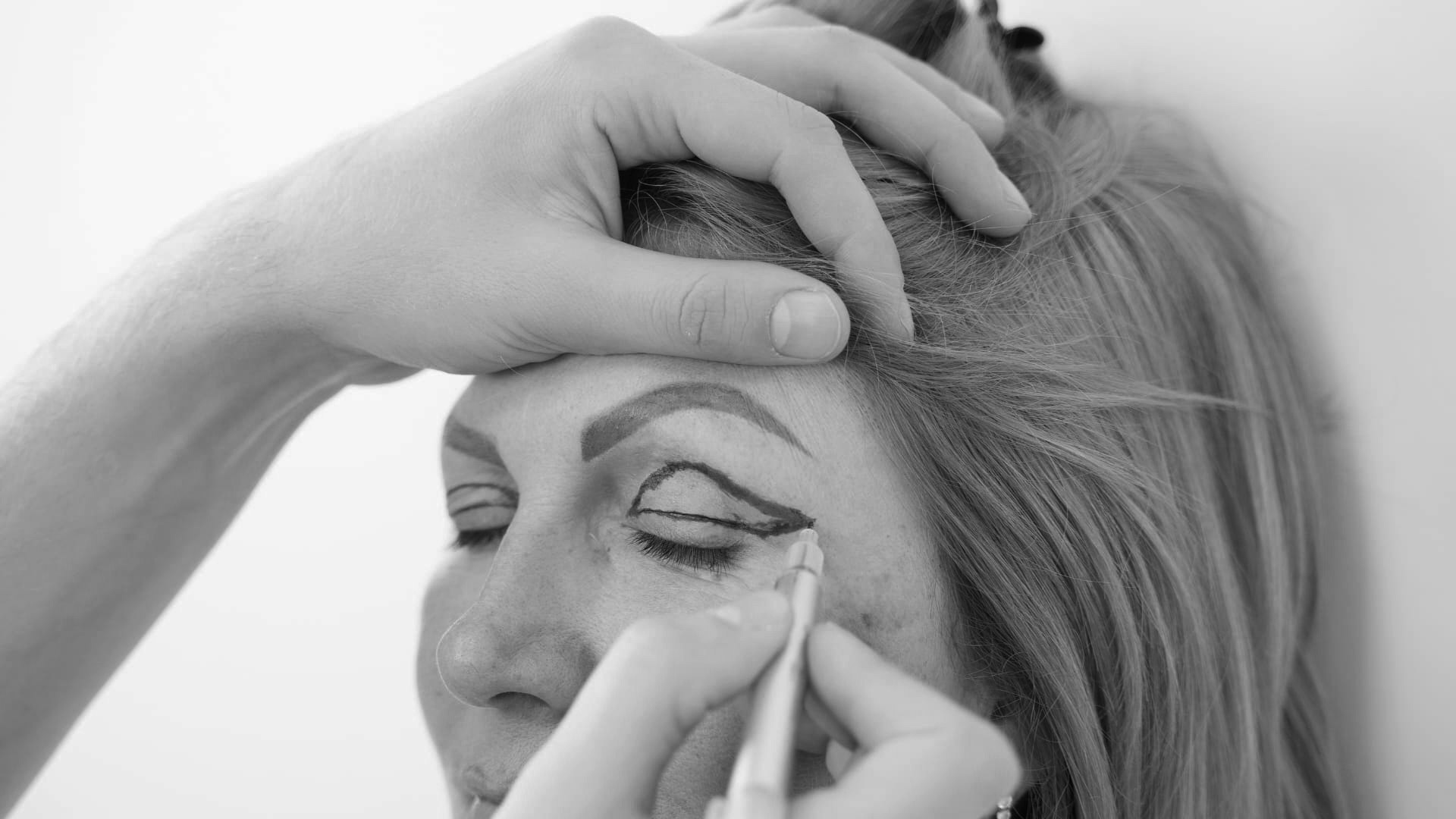 Eyelid loss: correcting drooping eyelids for a brighter look